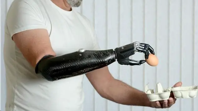 PRÓTESIS, FUNCIÓN Y SUS AVANCES A LO LARGO DE LA HISTORIA